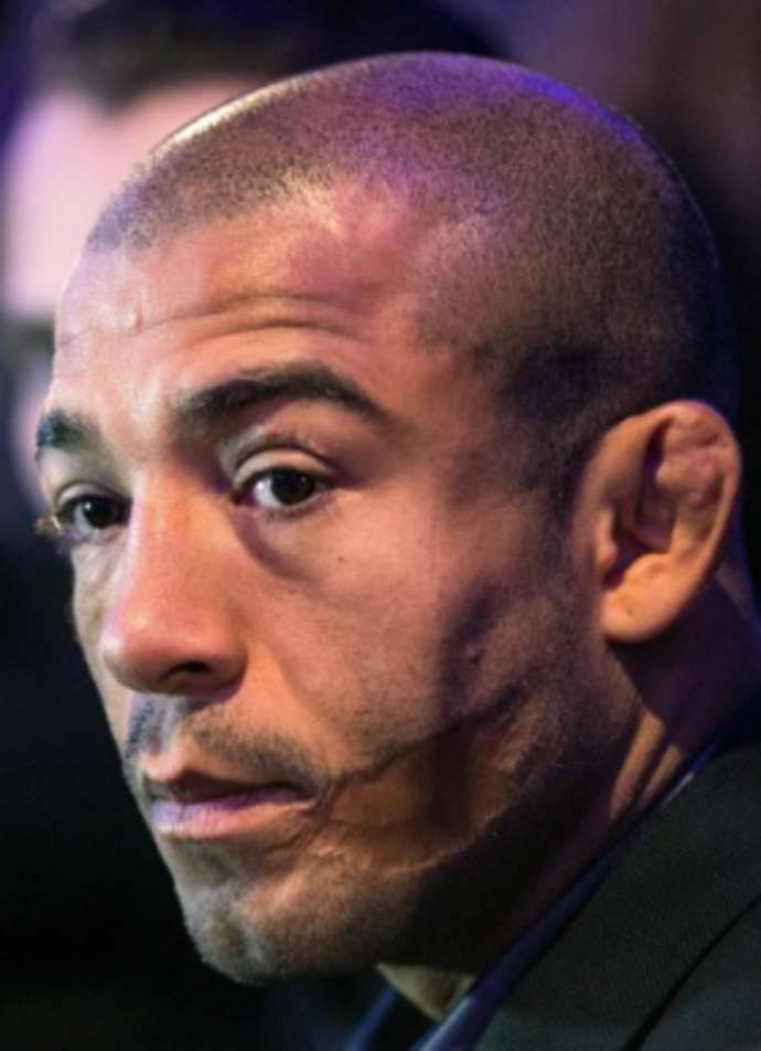 UFC news: How did Jose Aldo suffer the scar on his face?