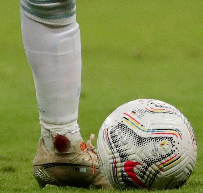 Argentina's Lionel Messi played with bloodied ankle after crunching ...