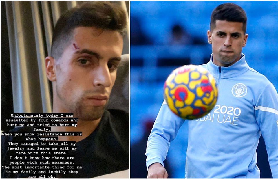 Joao Cancelo: Man City star posts image of facial injuries after being ...