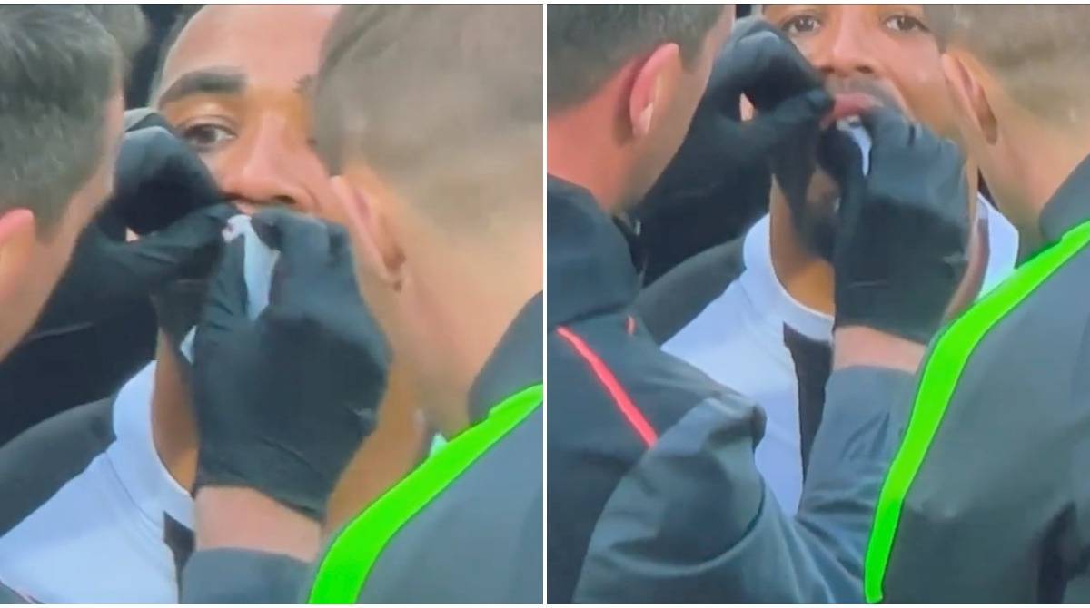 Newcastle's Callum Wilson's tooth was hanging by a thread after clash ...