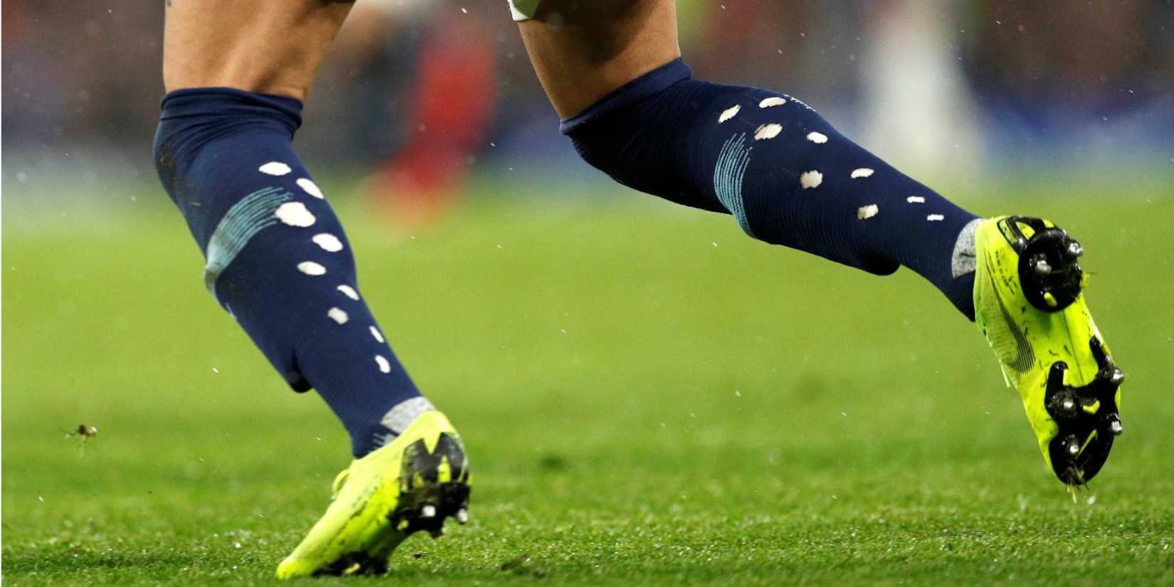 The Reason Why Footballers Cut Holes in their Socks