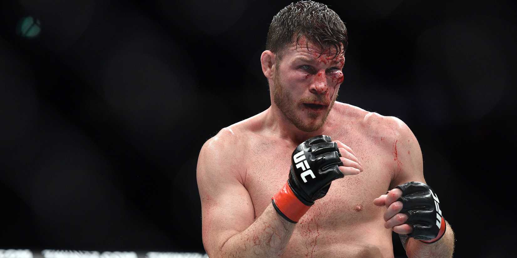 What Happened to UFC Hall of Famer Michael Bisping's Eye Explained