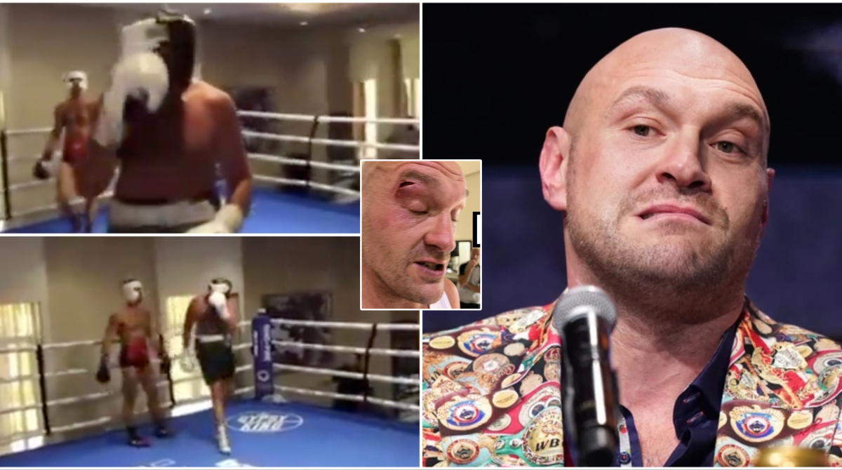 Footage shows cut that caused Tyson Fury vs Oleksandr Usyk to be postponed