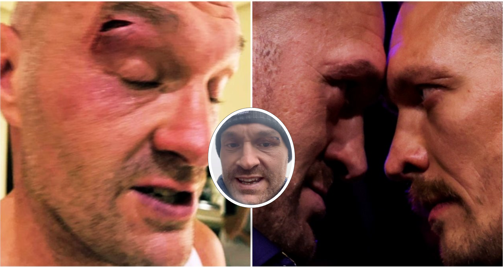 What Tyson Fury's cut looks like 10 days before proposed Oleksandr Usyk ...
