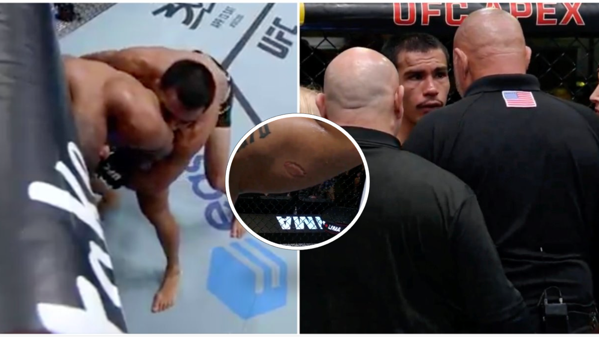 Igor Severino Sacked by UFC for Biting Opponent Mid-Fight