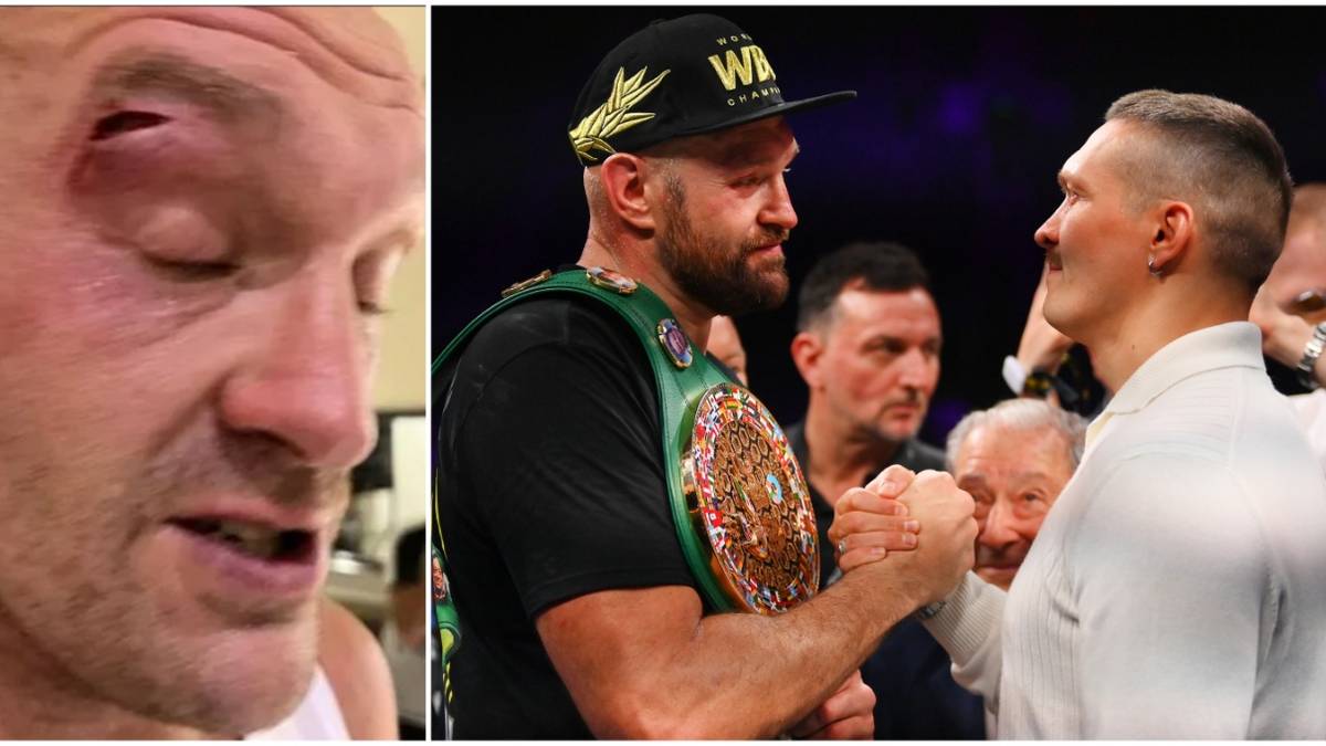 Tyson Fury's Cutman Provides Update on Injury That Postponed Usyk Fight