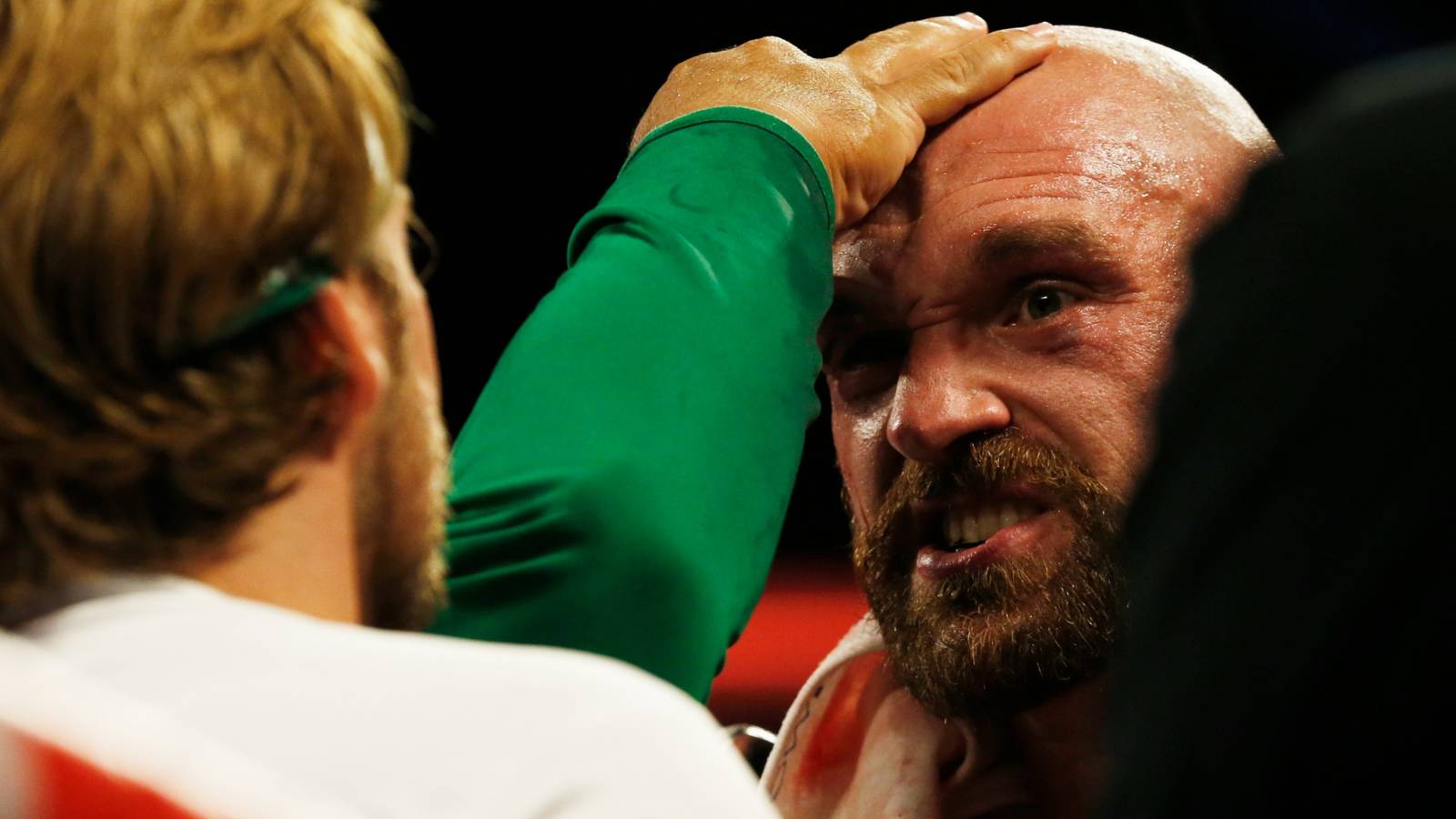 Cutwoman Issues Worrying Update on Tyson Fury's Injury Ahead of Usyk Fight