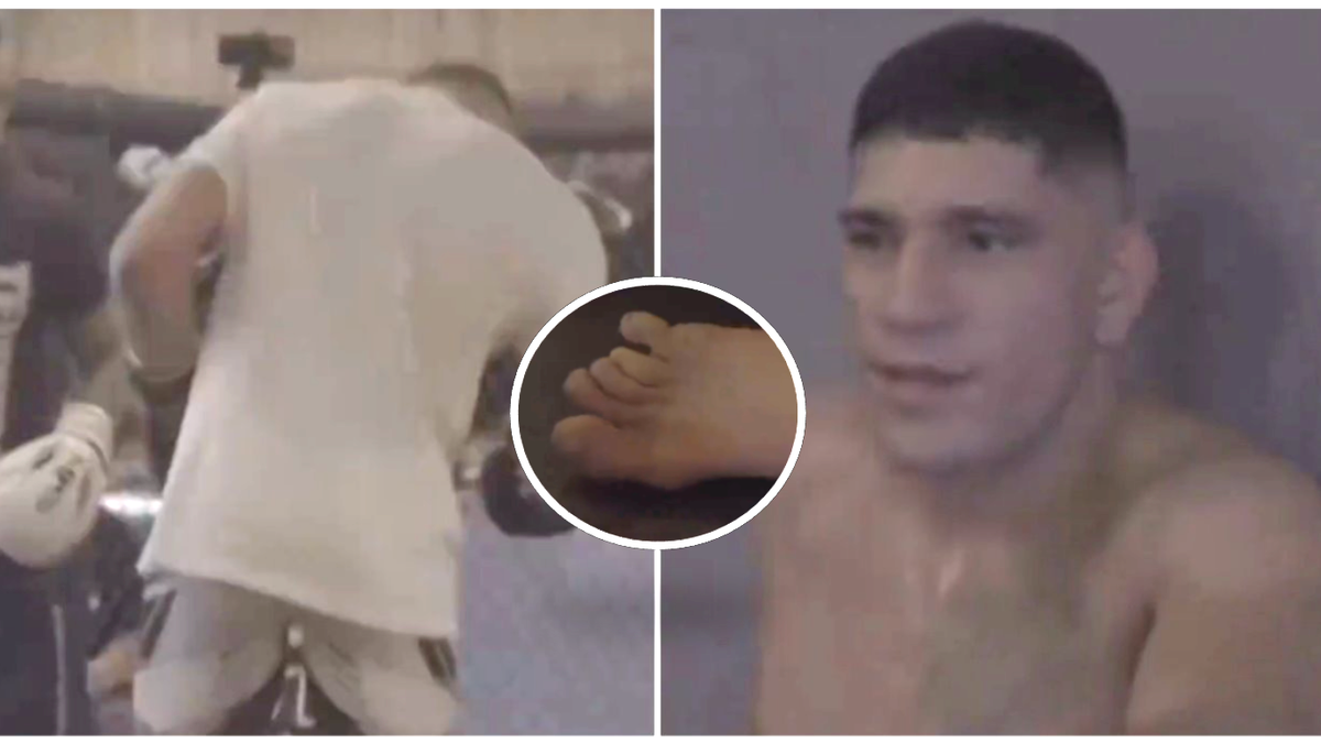 Alex Pereira Shares Footage of Broken Toe in Training Before UFC 300