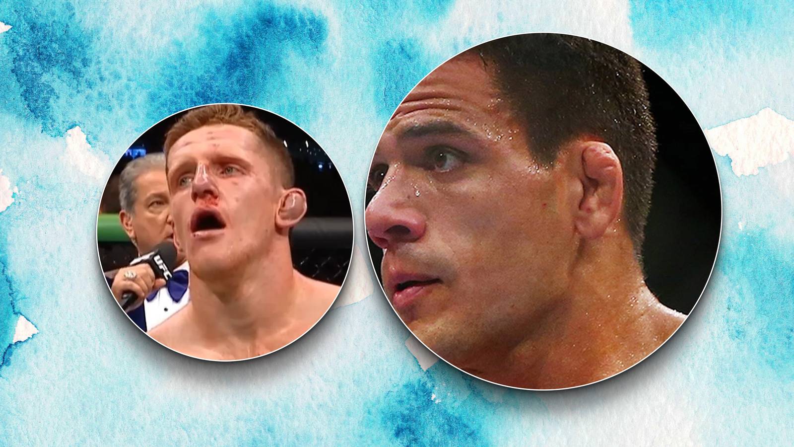 Why UFC Fighters Get Cauliflower Ears