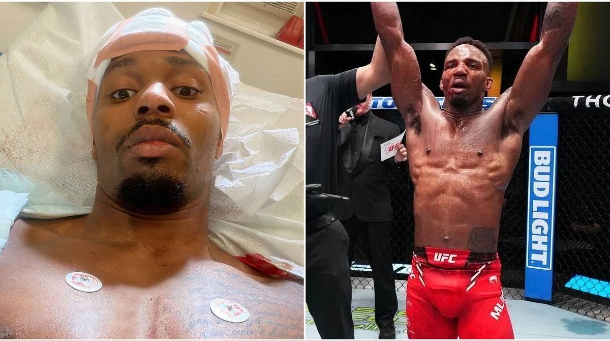 How Lerone Murphy Cheated Death Before Becoming a UFC Main Eventer