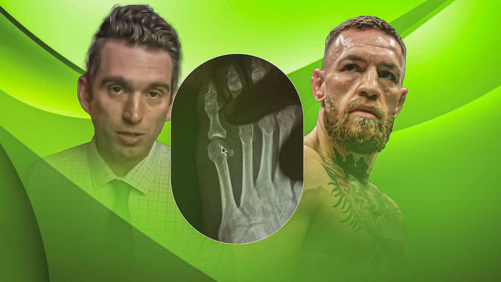 Doctor Gives Verdict on Conor McGregor's Broken Toe Ahead of UFC 303
