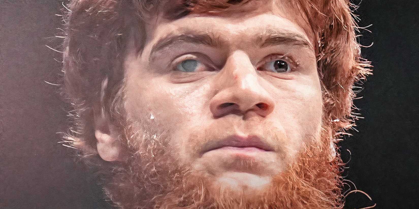 What Happened to UFC Fighter Sharaputdin Magomedov's Eye