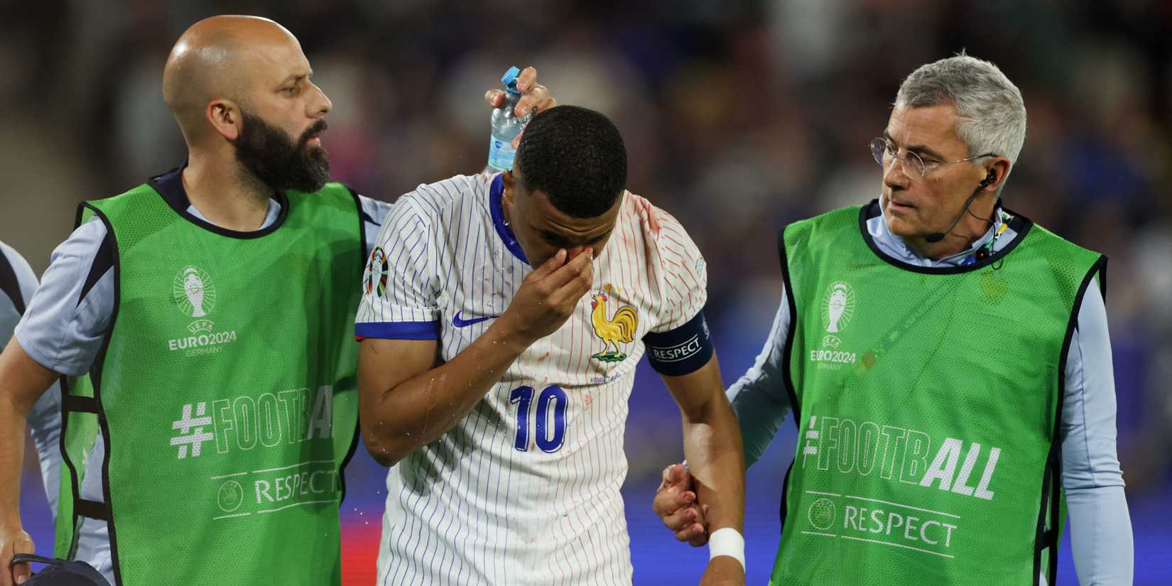 Why Footballers Wear Strange Masks on the Pitch