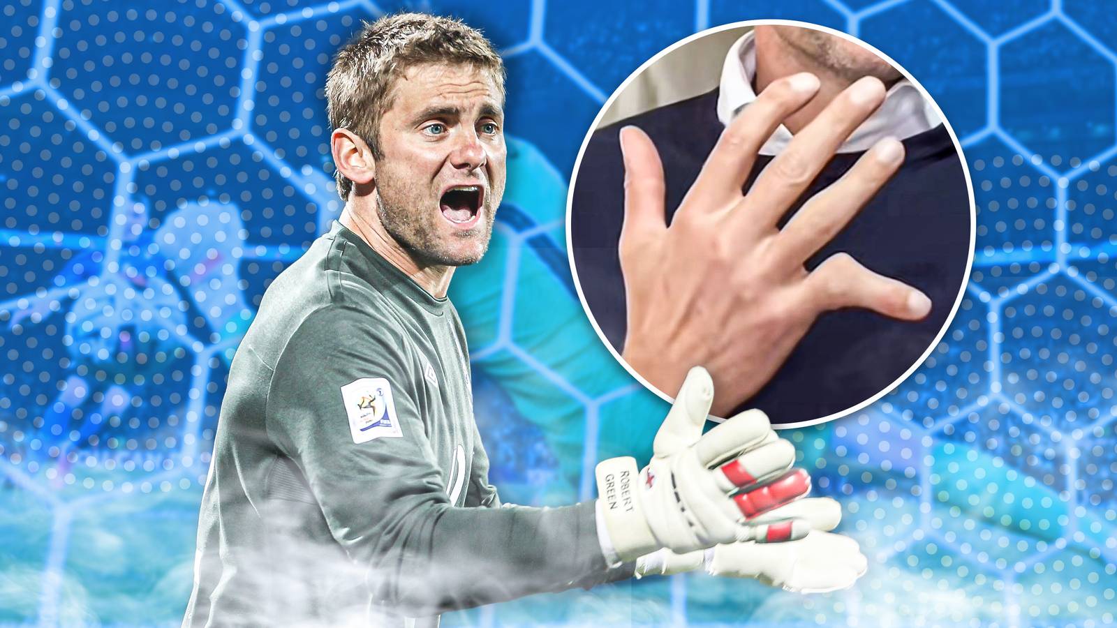 Rob Green Explains The Story Behind His Injured Little Finger
