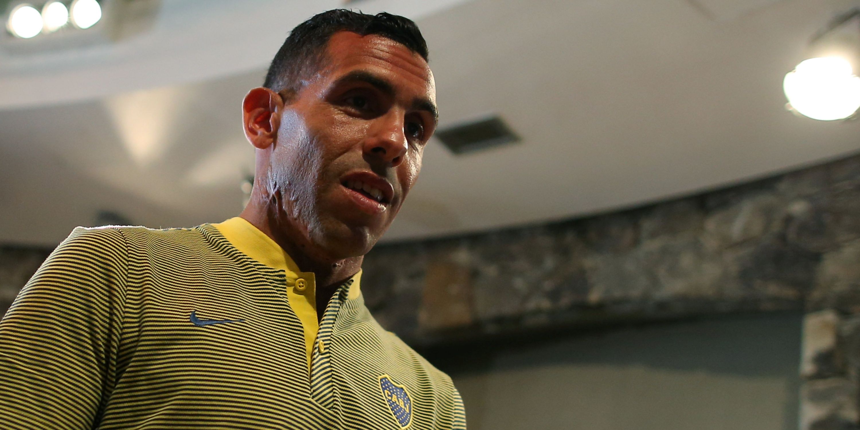 What Happened To Carlos Tevez Neck Scars