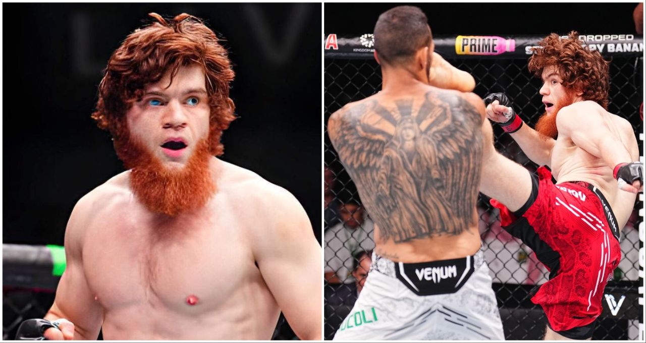 One-Eyed UFC Fighter Shara Magomedov Gives Update on Eligibility to ...