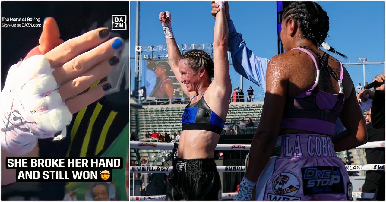 Novice Boxer Ginny Fuchs Shows Off Nasty Injury: 'I Broke it!'