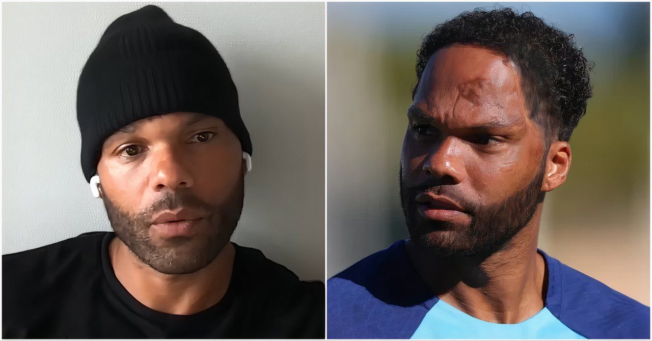 How Joleon Lescott Got His Facial Scars