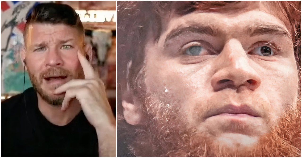 How Michael Bisping Inspired 'Bullet' Magomedov to Fight With Only One Eye