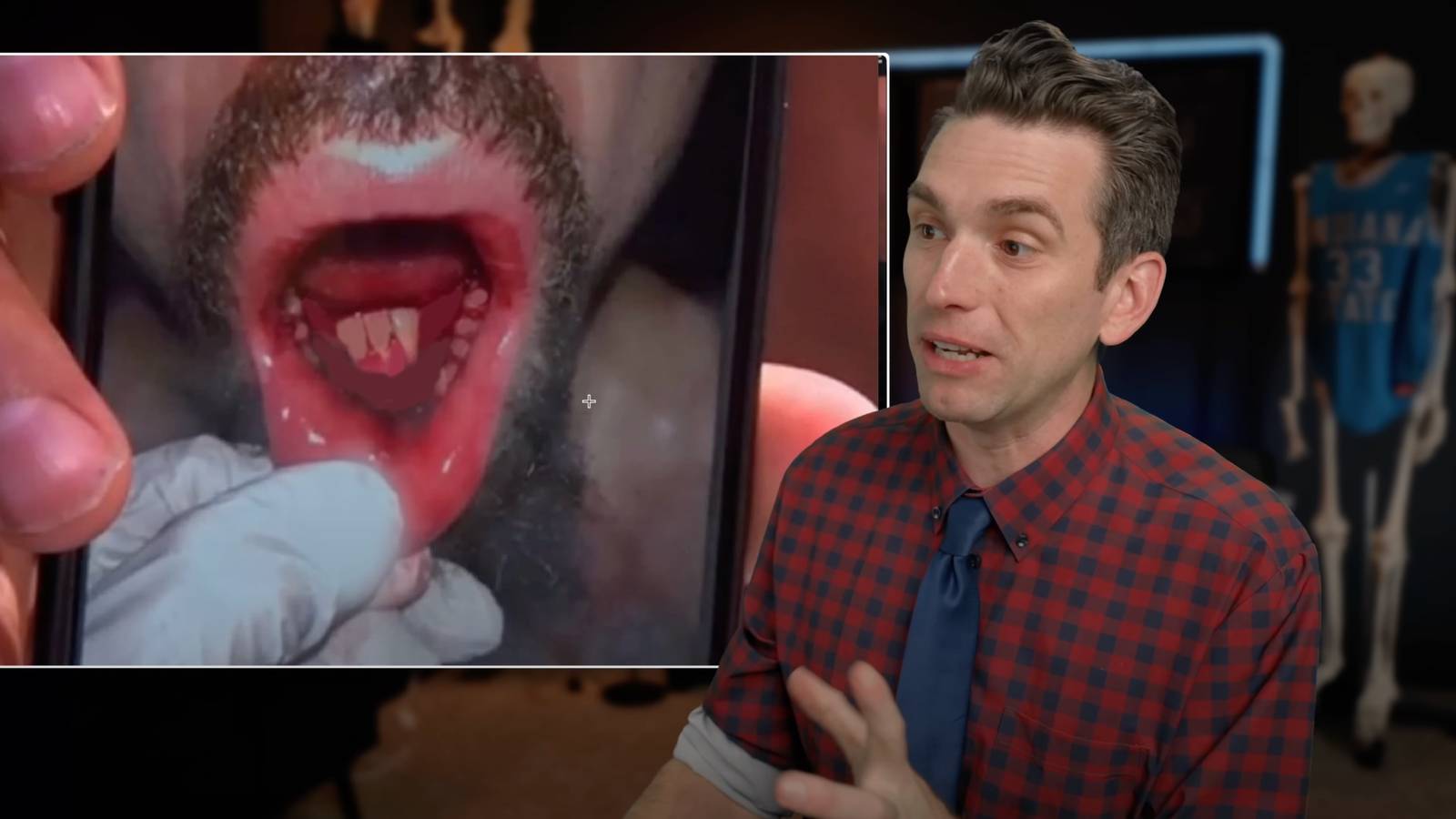 Sports Doctor Breaks Down Robert Whittaker's Jaw Injury After UFC 308