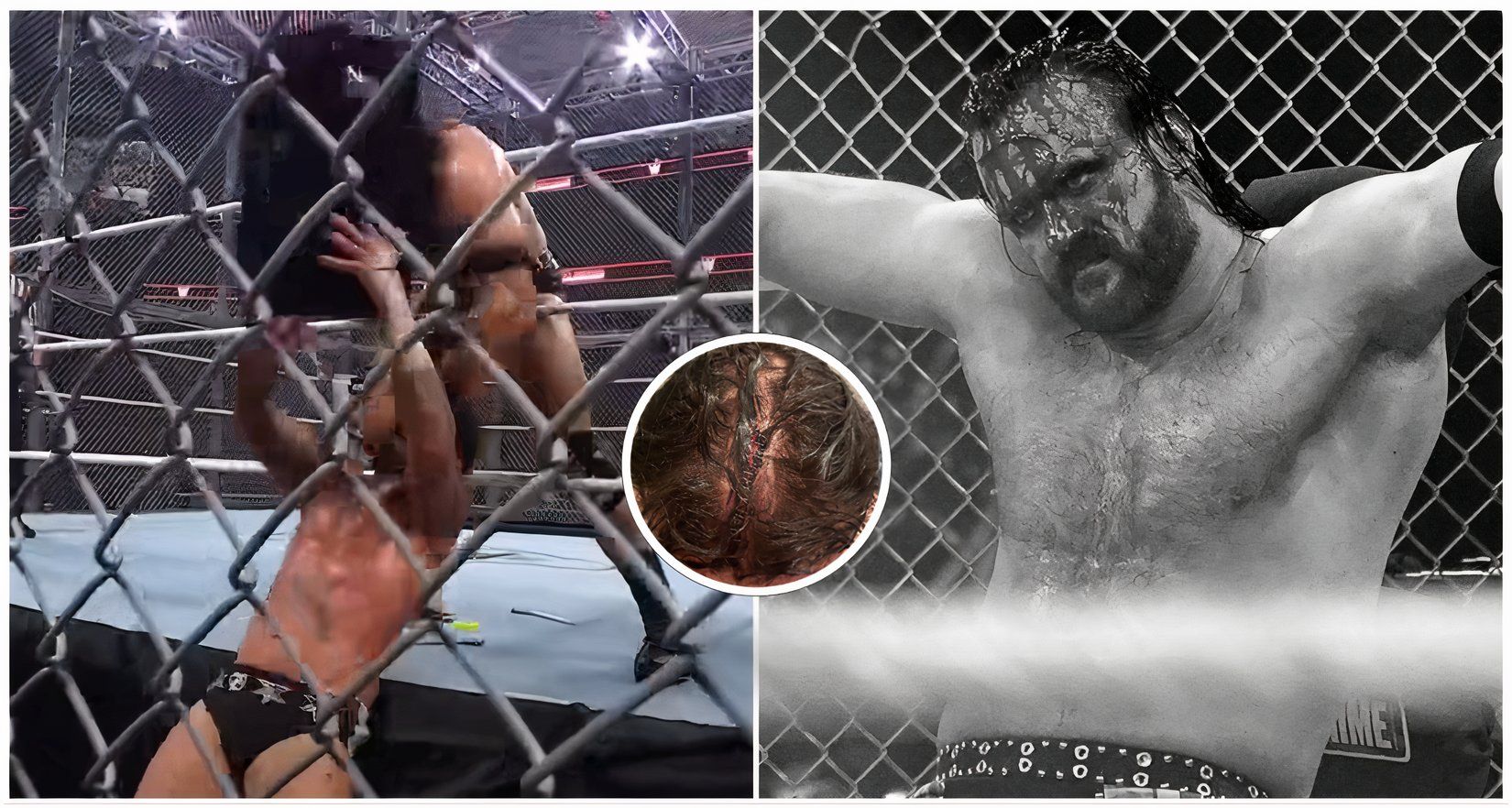 Drew McIntyre's Skull After CM Punk Hell in a Cell Match at WWE Bad Blood