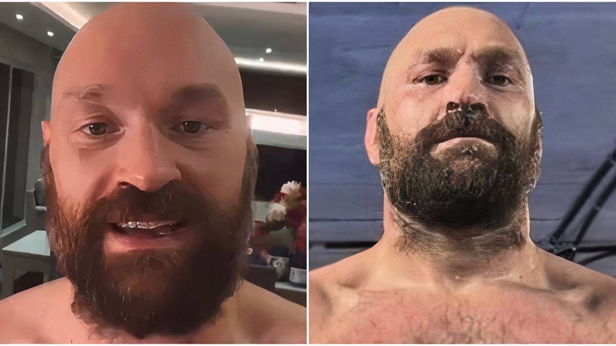 Tyson Fury's Current Physique Ahead of Oleksandr Usyk Rematch