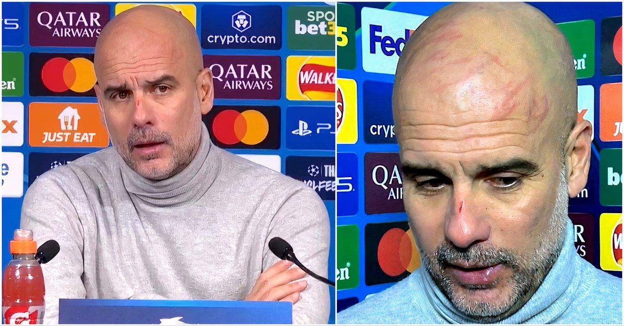 Pep Guardiola’s Concerning Response When Asked About Cuts and Bruises