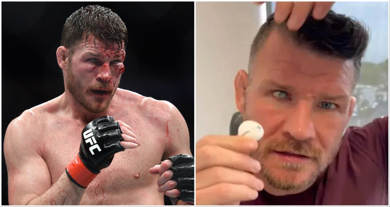 How Michael Bisping Used to Pass UFC Medicals Despite Being Blind in ...