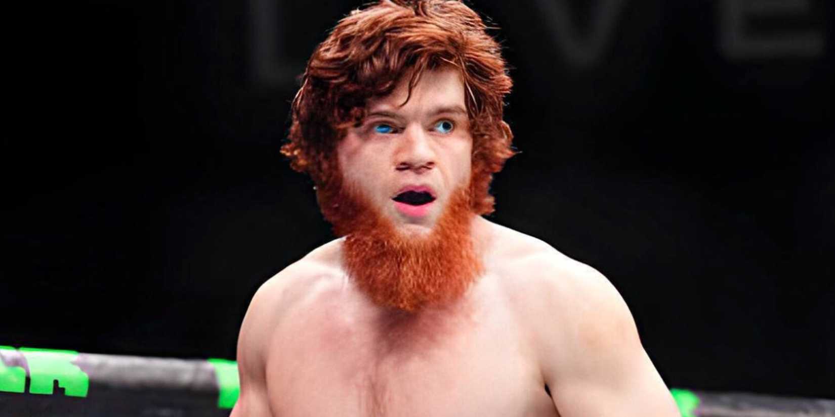 Shara 'Bullet' Magomedov's Painful Update After Surgery From Brutal Injury