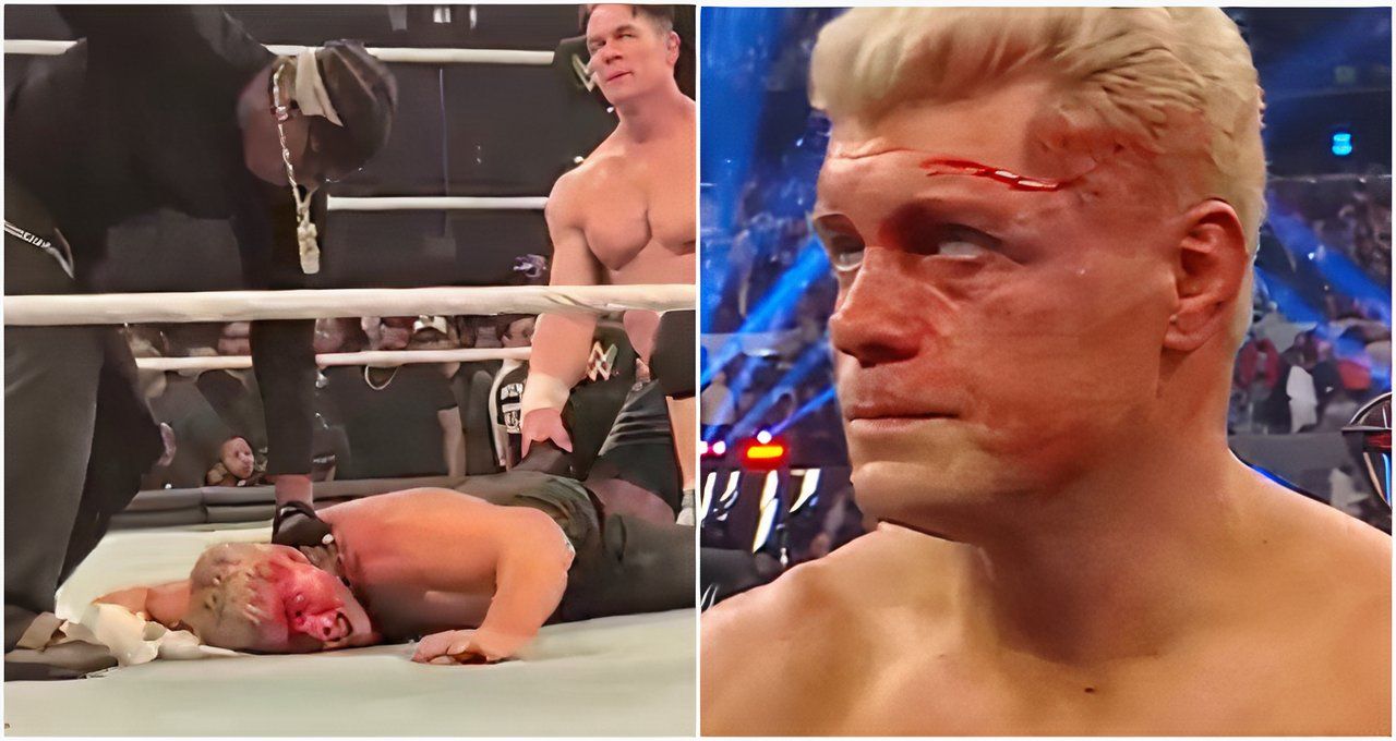 WWE Champion Cody Rhodes Suffered Real Injuries After Travis Scott Slap