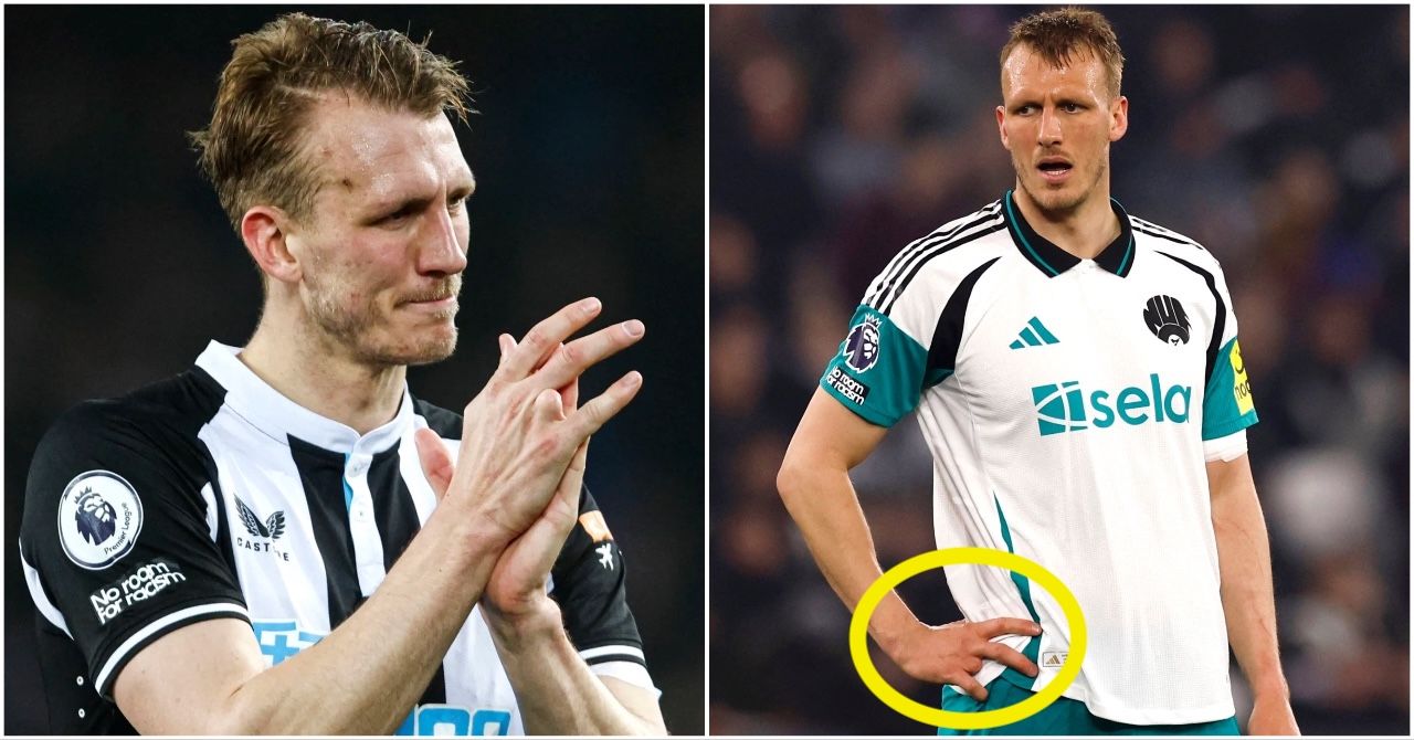 The Horrifying Story Behind Dan Burn's Missing Finger