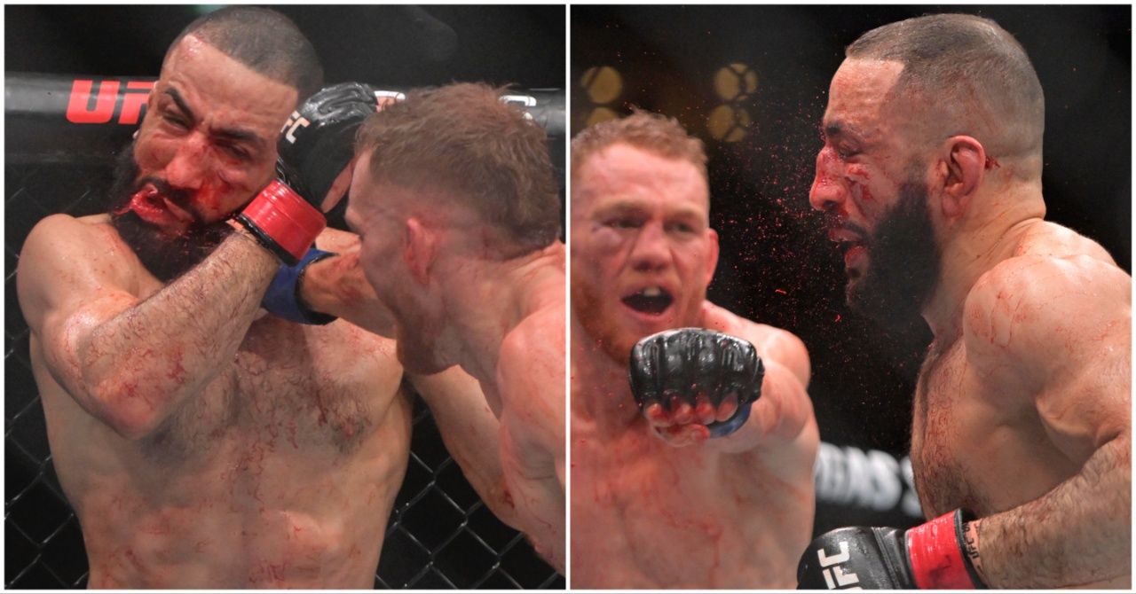 Photos Show Belal Muhammad's Face Looked Mangled After UFC 315 Loss to ...