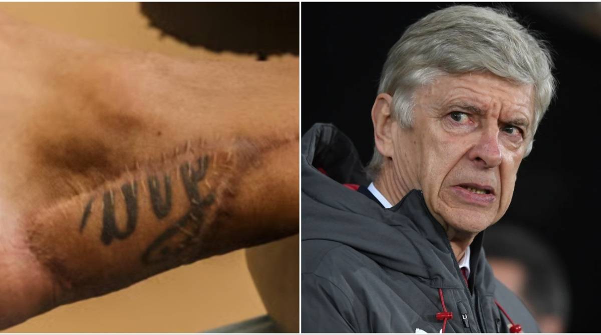 Arsene Wenger Named 'Worst' Arsenal Injury He Ever Saw - Wasn't Ramsey ...