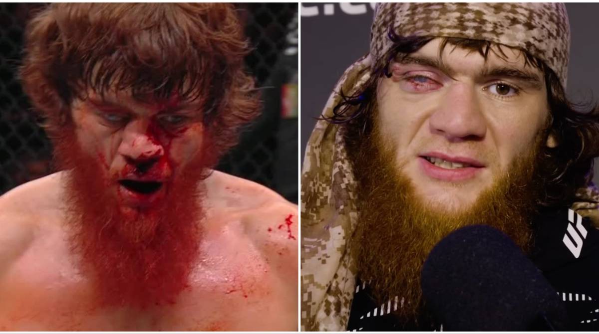 Shara 'Bullet' Magomedov's Painful Update After Surgery From Brutal Injury