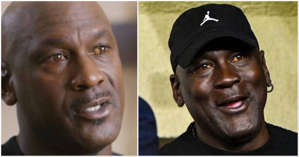 Why Michael Jordan's Eyes Are Yellow - Doctor Explains