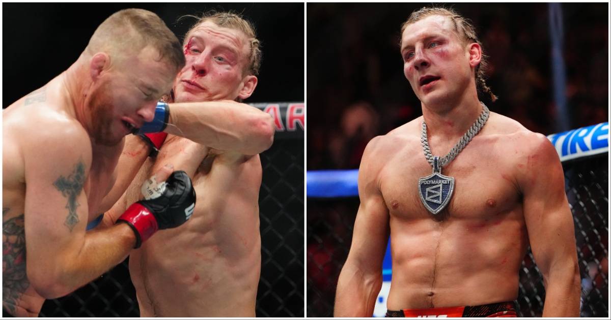Paddy Pimblett Breaks Silence After UFC 324 Defeat With Medical Update