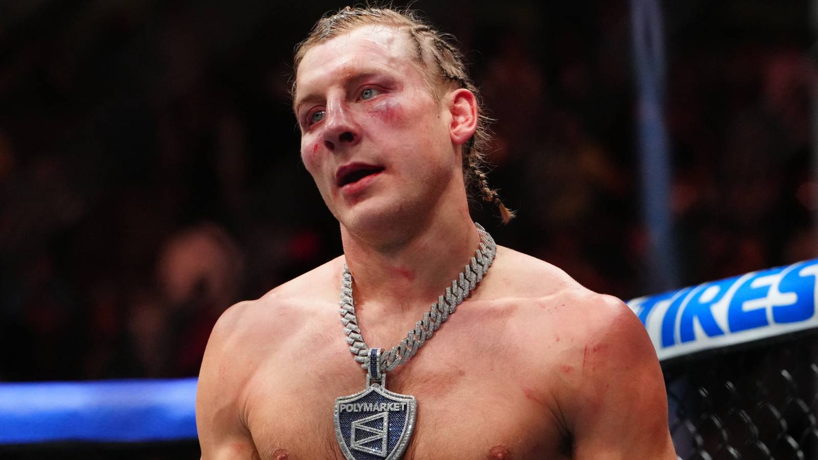 Paddy Pimblett Breaks Silence After UFC 324 Defeat With Medical Update